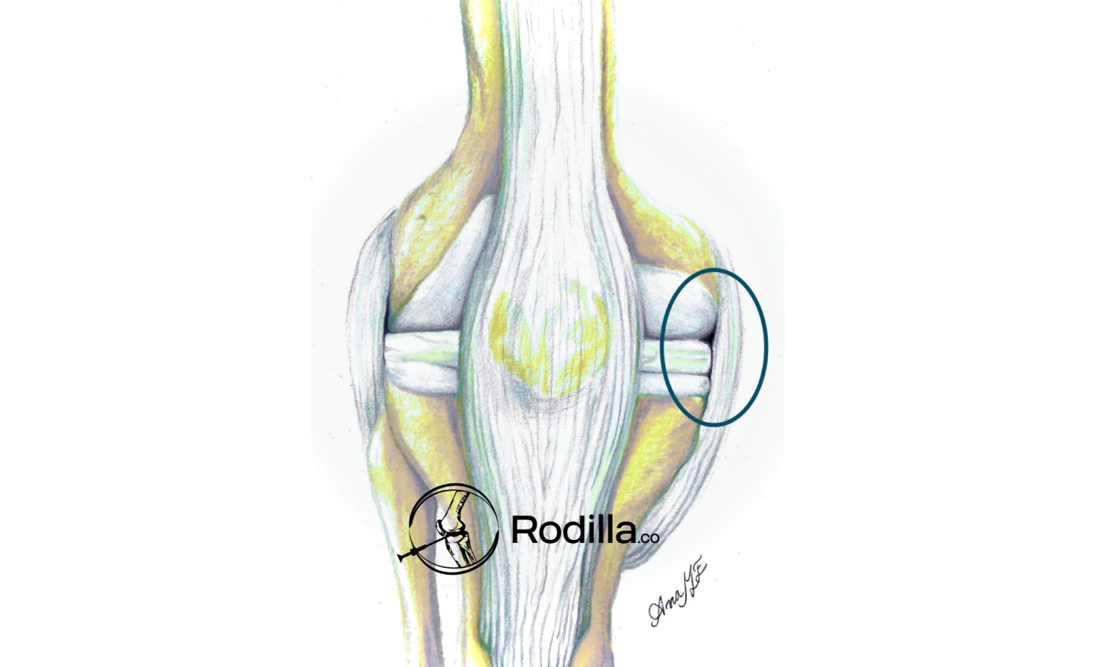 Ligamento Colateral Medial (LCM) – rodilla.co
