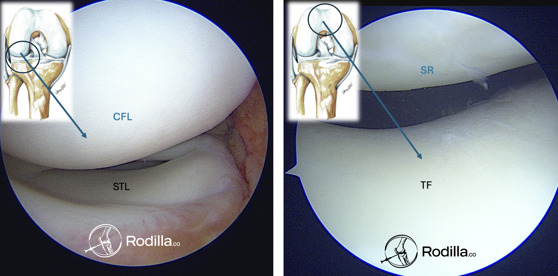 Cartílago – rodilla.co